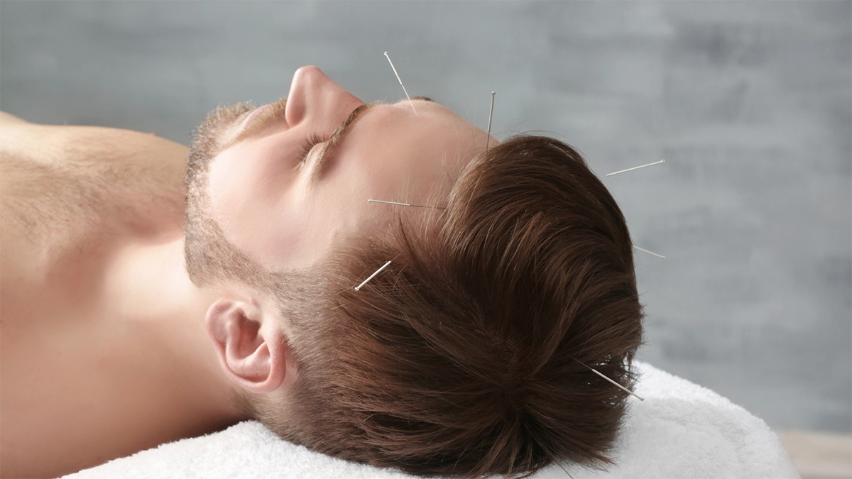 Acupuncture for Detox: A Holistic Approach to Withdrawal | South Coast ...